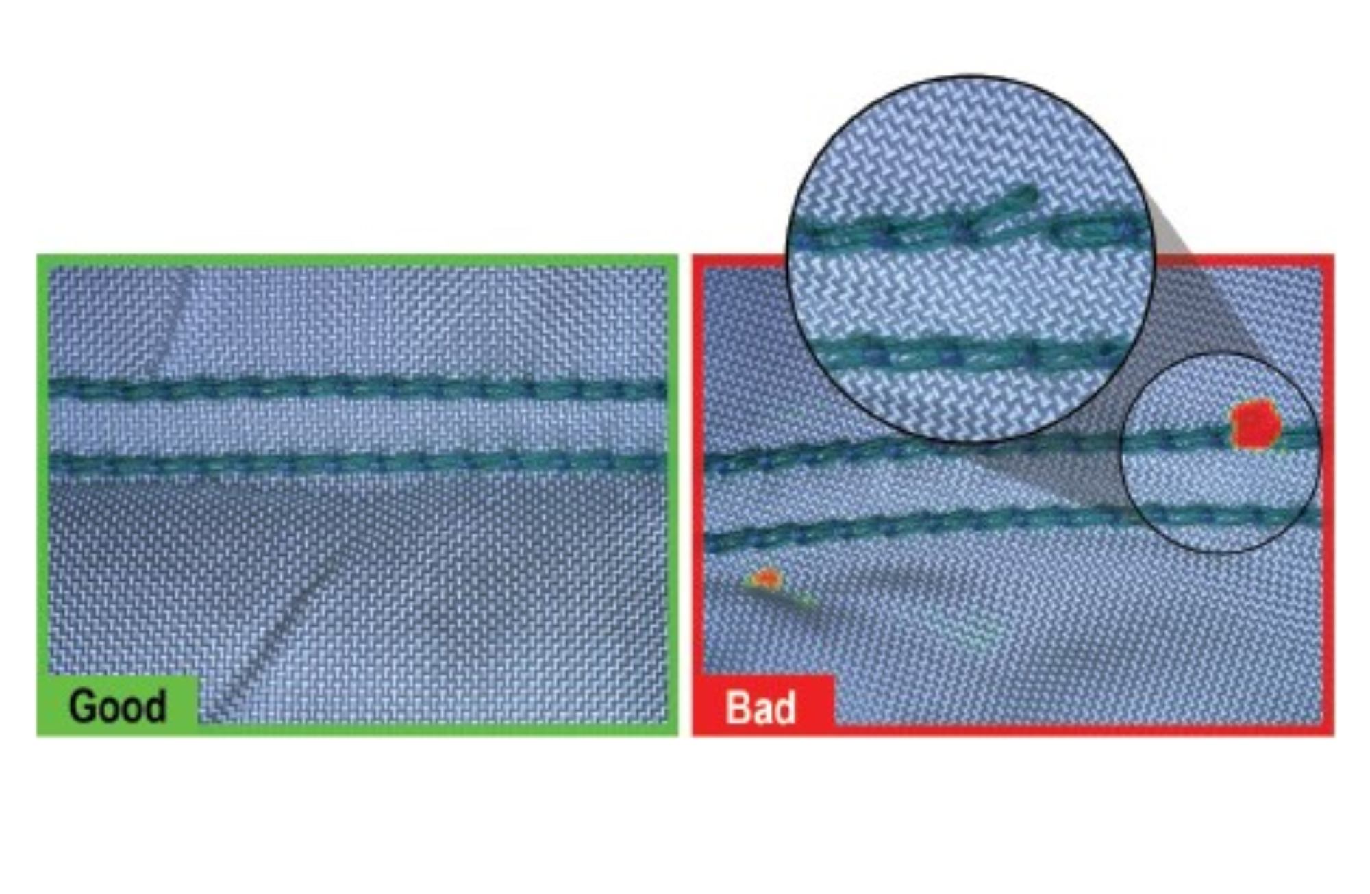 Stitching Defect Detection Using Machine Vision Ai